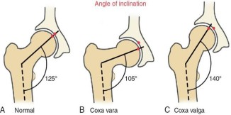 How To Solve The Most Common Squat Problems. - Personal Trainer Dublin